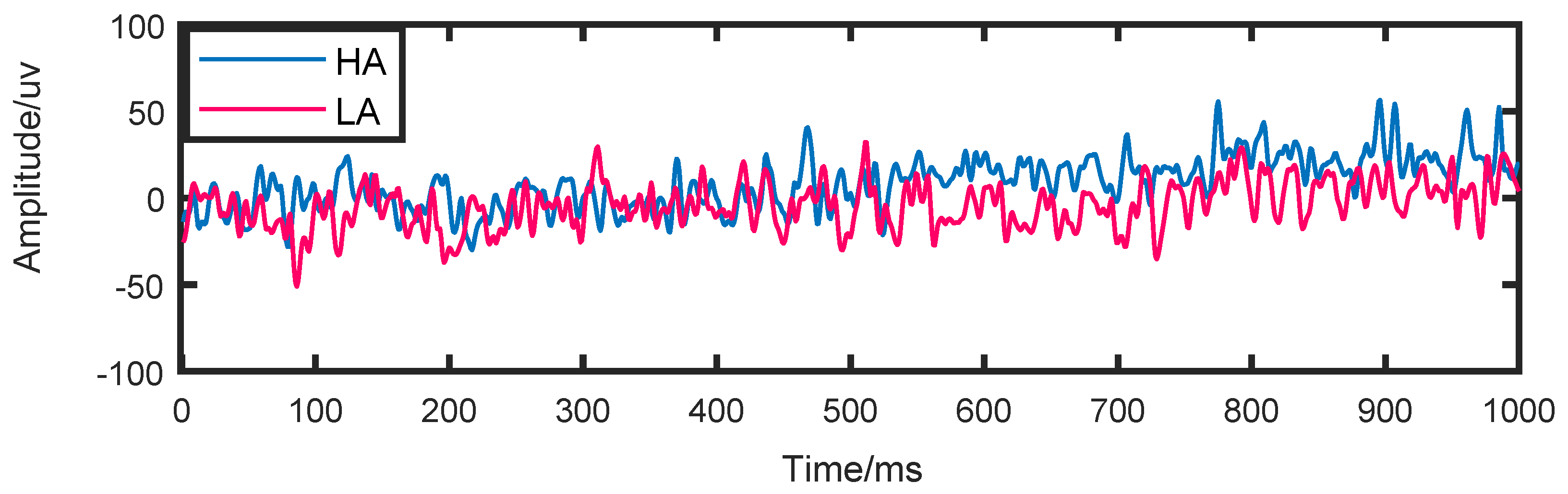 EEG-Based Attention Classification for Enhanced Learning Experience