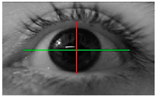 ASI | Free Full-Text | Gaze-Guided Control of an Autonomous Mobile Robot Using Type-2 Fuzzy Logic