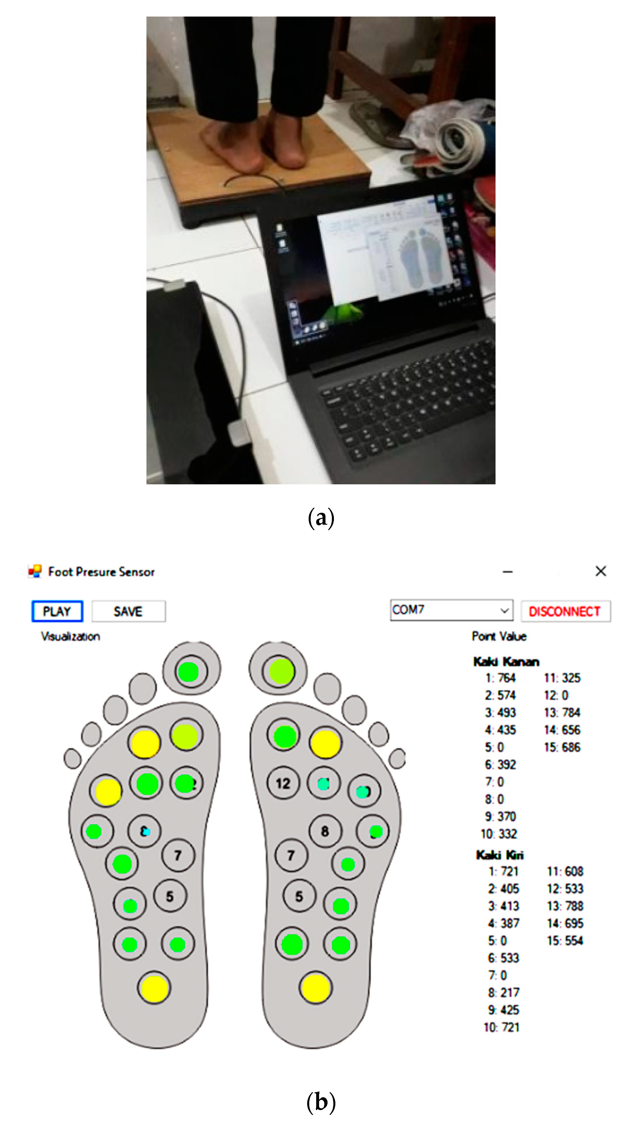 A Simple Foot Plantar Pressure Measurement Platform System Using Force ...