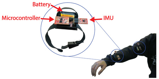 Wireless Motion Capture System for Upper Limb Rehabilitation