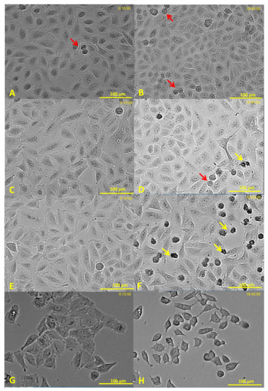 The Toxic Effect of Water-Soluble Particulate Pollutants from Biomass ...