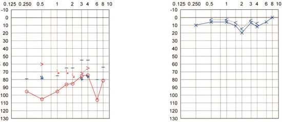 Audiology Research | An Open Access Journal from MDPI