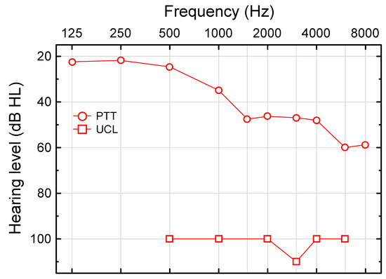 Audiology Research | An Open Access Journal from MDPI