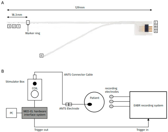 Intraoperative Assessment of Cochlear Nerve Function During Cochlear ...