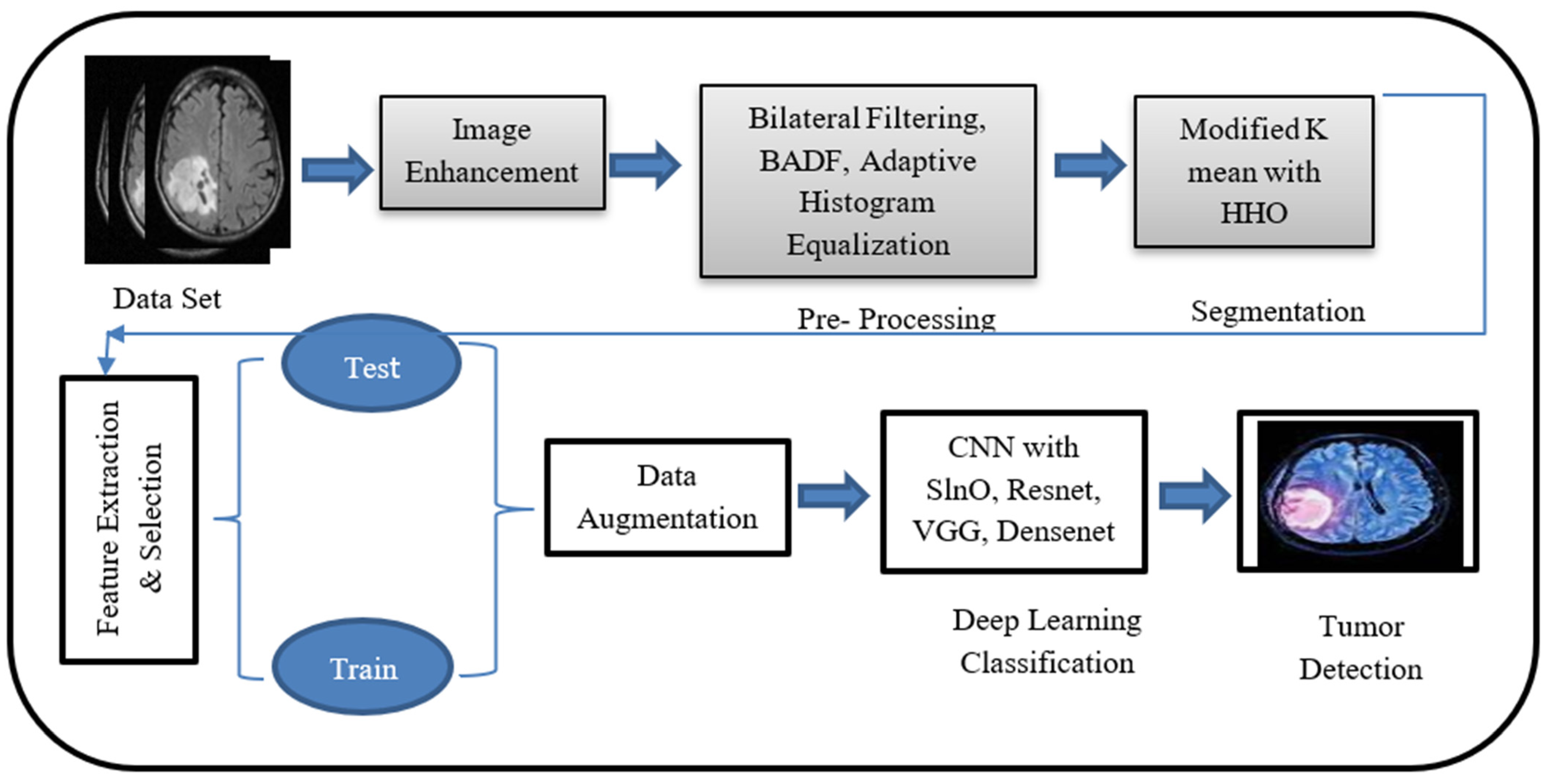 Automated Detection and Classification of Meningioma Tumor from MR Images Using Sea Lion ...