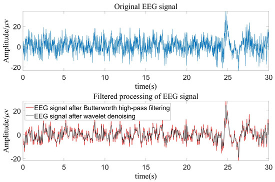 Axioms | Free Full-Text | Automatic Sleep Staging Based on Single-Channel EEG Signal Using Null ...