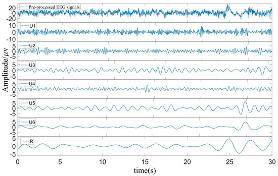 Axioms | Free Full-Text | Automatic Sleep Staging Based on Single-Channel EEG Signal Using Null ...