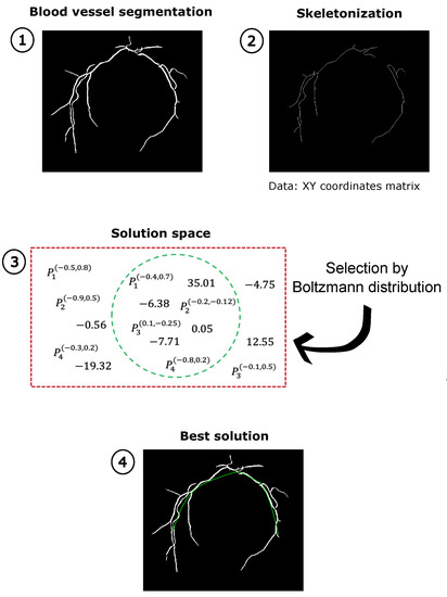 Numerical Modeling of the Major Temporal Arcade Using BUMDA and Jacobi ...