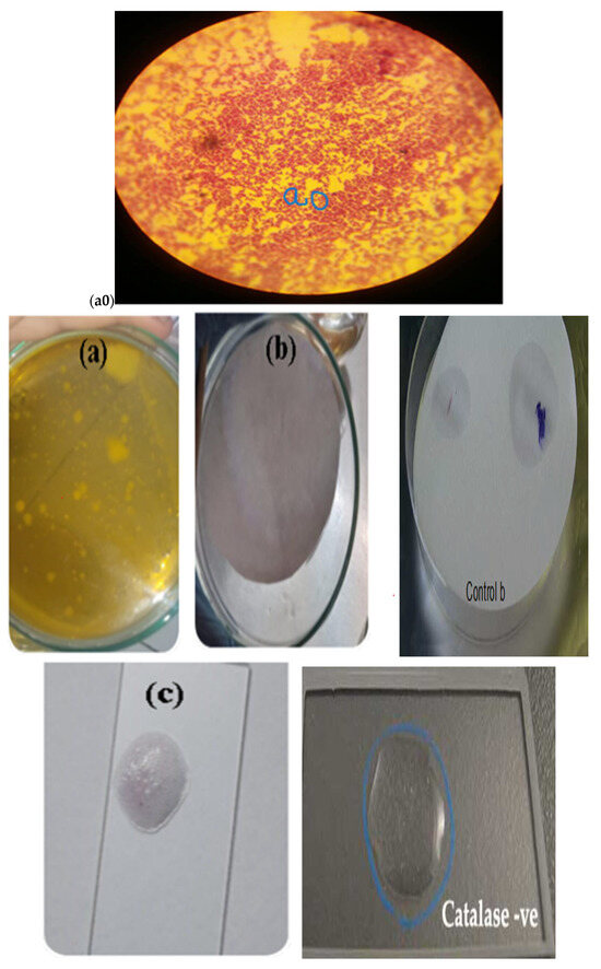 Comprehensive Analysis of Klebsiella pneumoniae Culture Identification ...