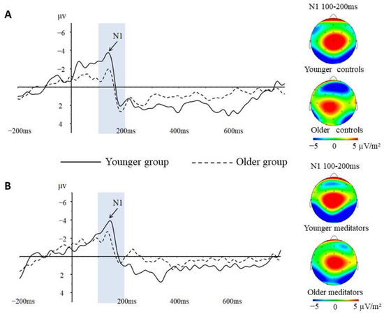 Impact of Long-Term Shaolin Zen Meditation on Emotional Processing in ...