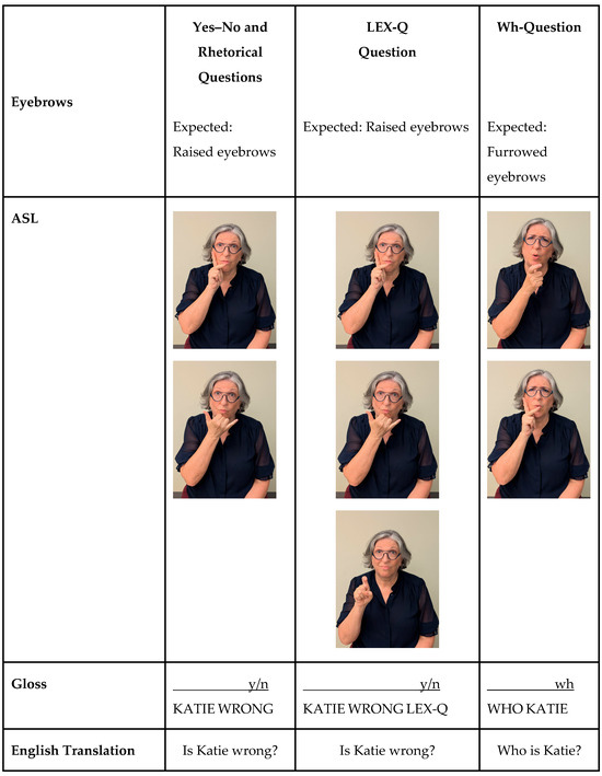 A Case Study of a Deaf Autistic Adolescent’s Affective and Linguistic ...