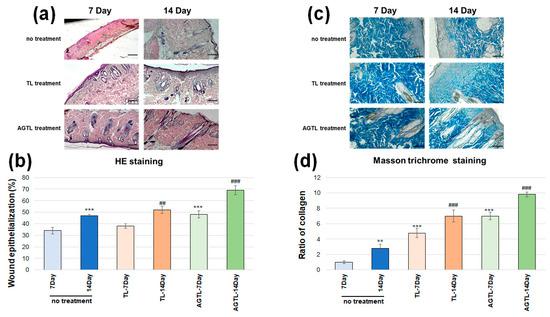 Hydrogels Made with Tilapia Fish Skin Increase Collagen Production and ...
