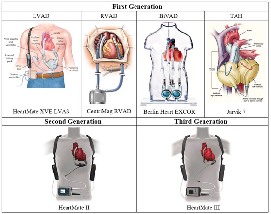 Cardiac Assist Devices: Early Concepts, Current Technologies, and Future Innovations