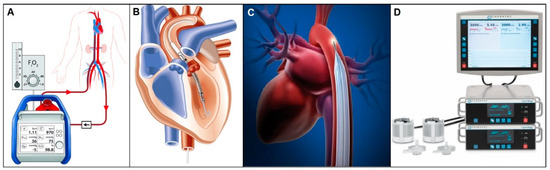 Cardiac Assist Devices: Early Concepts, Current Technologies, and ...