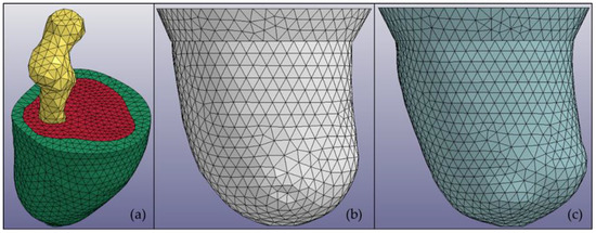 Analysis of Pressure Distribution in Transfemoral Prosthetic Socket for ...