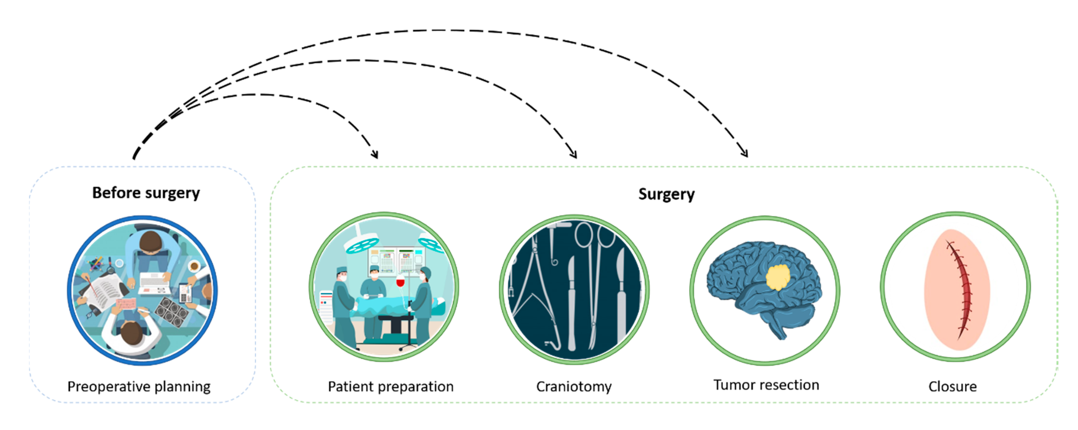 Bioengineering | Free Full-Text | Current Practice in Preoperative ... Bioengineering | Free Full-Text | Current Practice in Preoperative ...