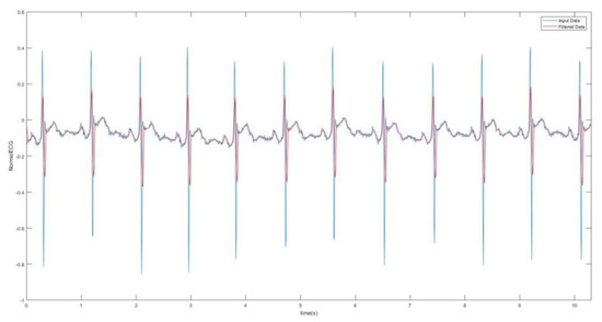 Early Detection of Atrial Fibrillation Based on ECG Signals