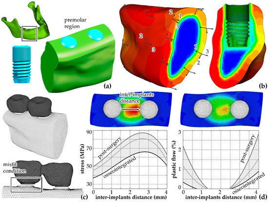 Computational Biomechanics: In-Silico Tools for the Investigation of Surgical Procedures and Devices
