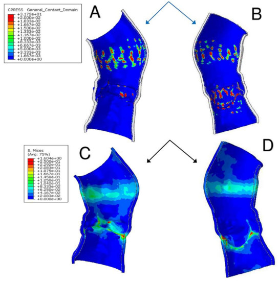 Bioengineering | Special Issue : The Next Generation of Prosthetic ...
