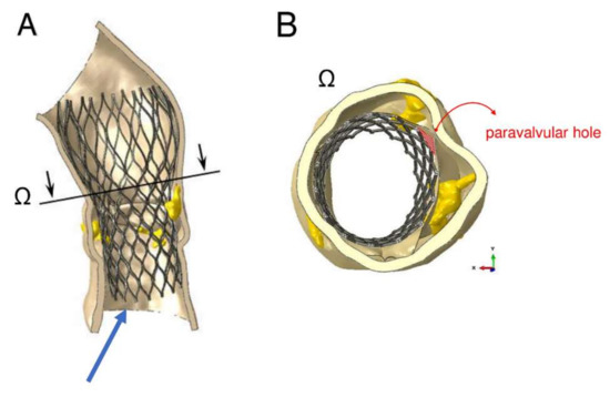 Bioengineering | Special Issue : The Next Generation of Prosthetic ...