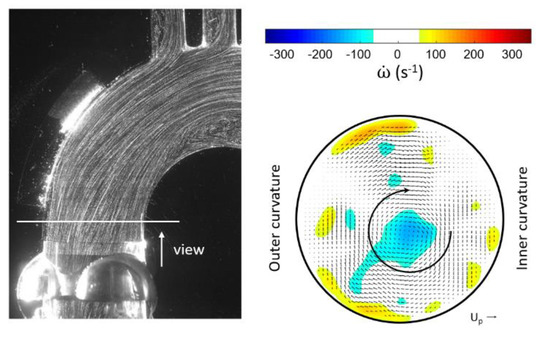 Bioengineering | Special Issue : The Next Generation of Prosthetic ...