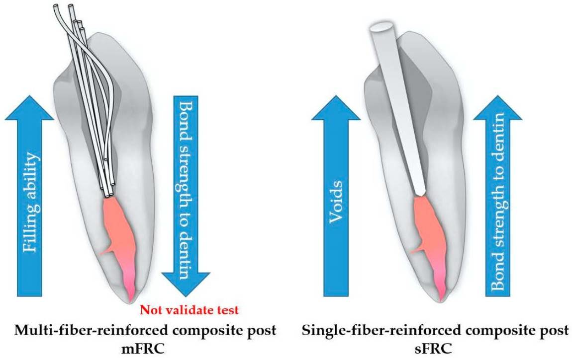 Bioengineering | Free Full-Text | Does Multi-Fiber-Reinforced Composite ...