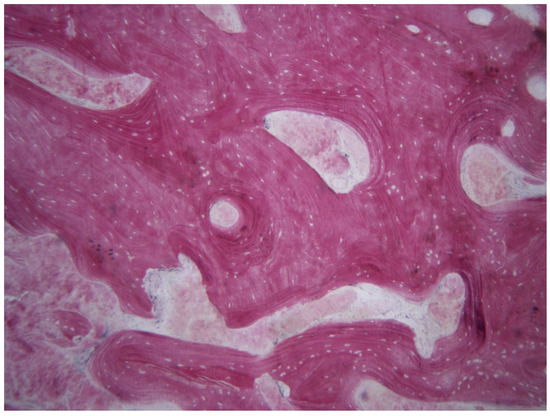 Bioengineering | Free Full-Text | Computer-Guided Bone Biopsy: A ...