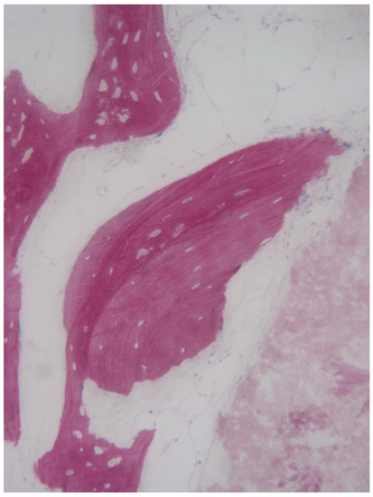 Bioengineering | Free Full-Text | Computer-Guided Bone Biopsy: A ...