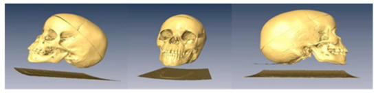 Bioengineering | An Open Access Journal from MDPI