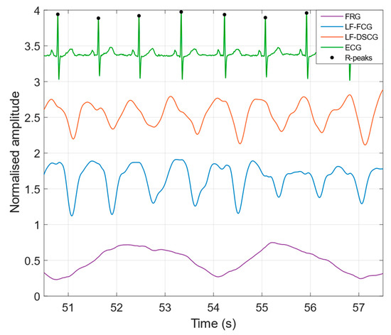 A Comparison of Heart Pulsations Provided by Forcecardiography and ...