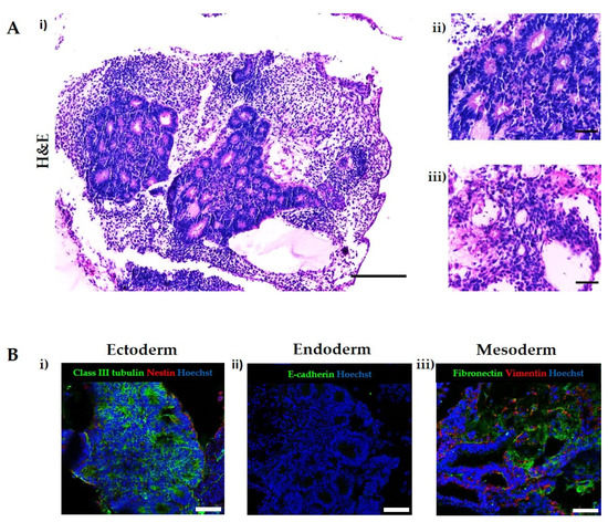 Recreating Tissue Structures Representative of Teratomas In Vitro Using a Combination of 3D Cell ...