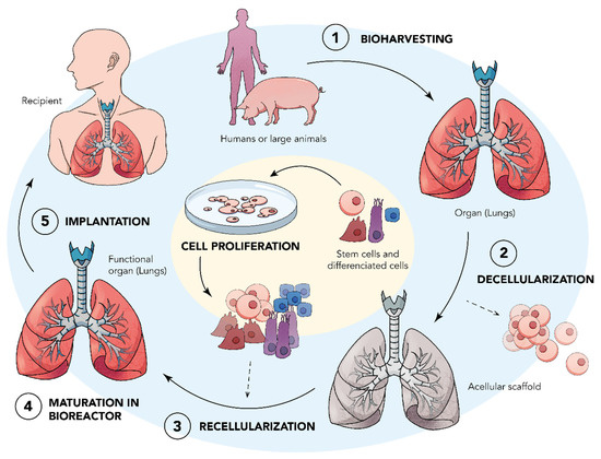 Emerging Paradigms in Bioengineering the Lungs