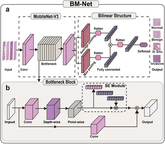 BM-Net: CNN-Based MobileNet-V3 and Bilinear Structure for Breast Cancer ...