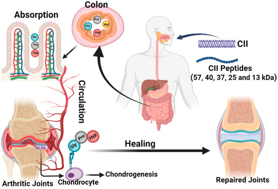 Paradoxical Duel Role of Collagen in Rheumatoid Arthritis: Cause of ...
