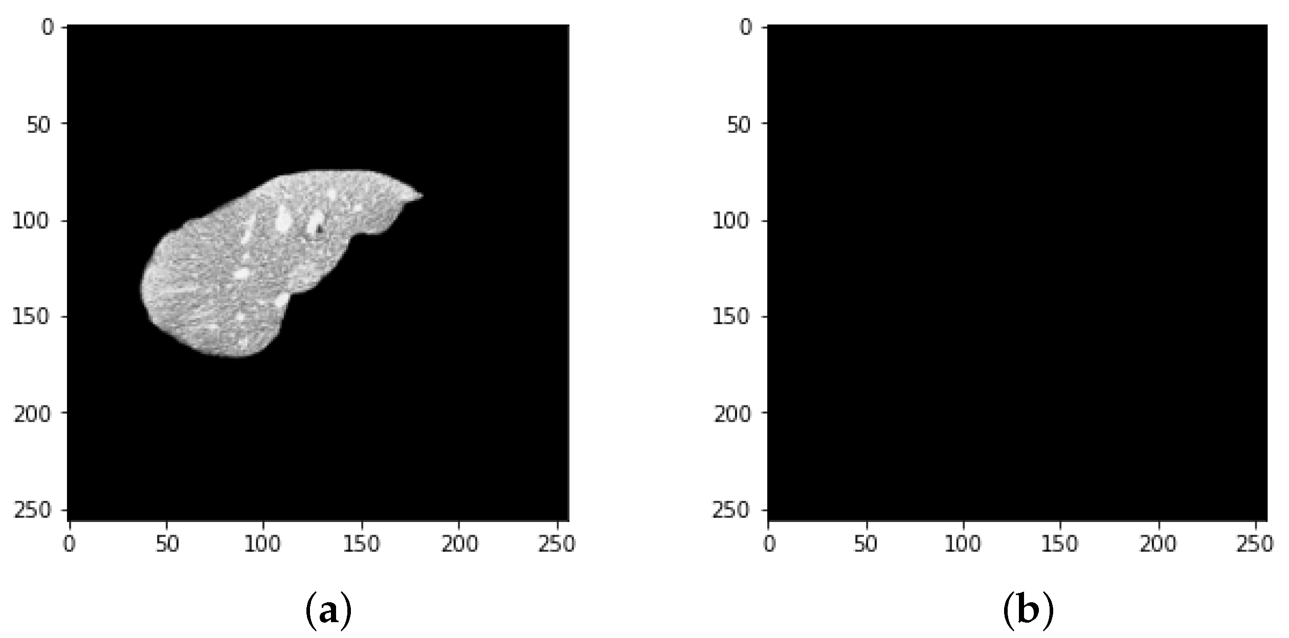 A Deep Learning Approach for Liver and Tumor Segmentation in CT Images Using ResUNet