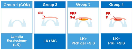 Initial Healing Effects of Platelet-Rich Plasma (PRP) Gel and Platelet ...