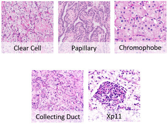 Development and Evaluation of a Novel Deep-Learning-Based Framework for ...
