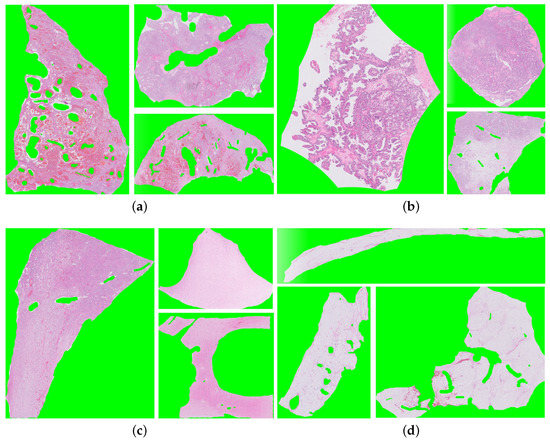 Development and Evaluation of a Novel Deep-Learning-Based Framework for ...