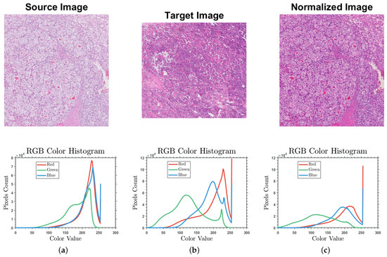 Development and Evaluation of a Novel Deep-Learning-Based Framework for ...