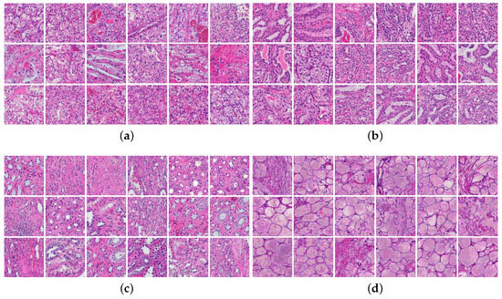 Development and Evaluation of a Novel Deep-Learning-Based Framework for ...