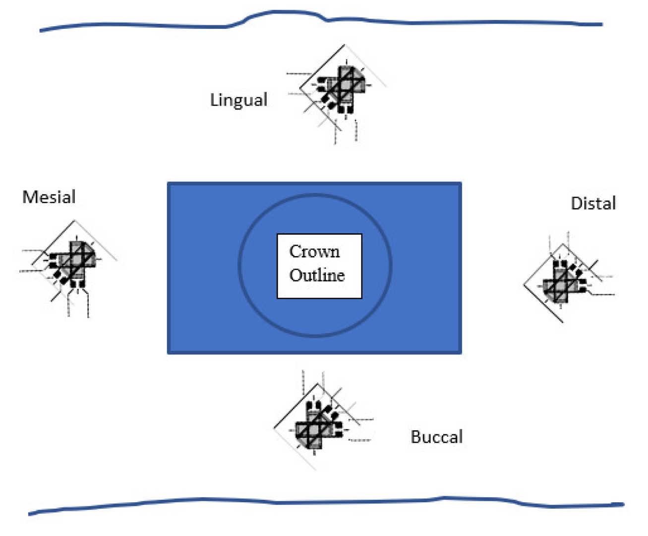 The Biomechanical Profile of an Osseo-Integrated Rectangular Block ...