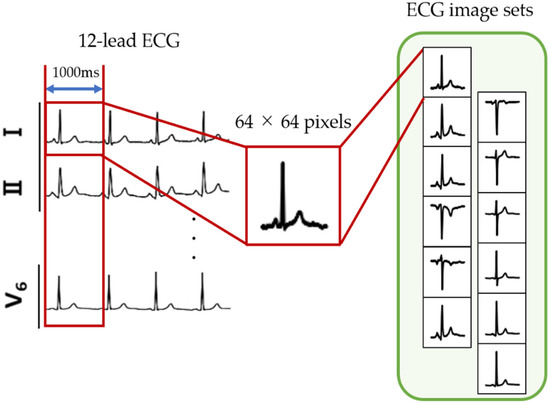 End-to-End Convolutional Neural Network Model to Detect and Localize ...