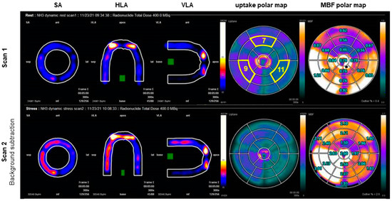 A Multimodality Myocardial Perfusion Phantom: Initial Quantitative ...