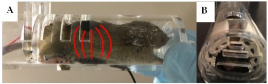 Bioengineering | Free Full-Text | Non-Invasive Transcutaneous Spinal DC ...