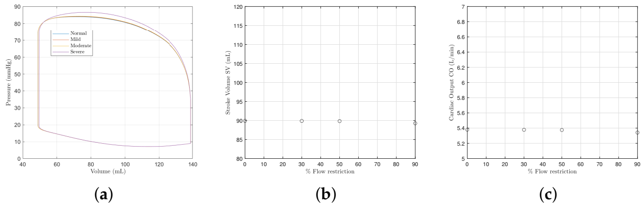 Bioengineering | Free Full-Text | An Investigation of Left Ventricular ...