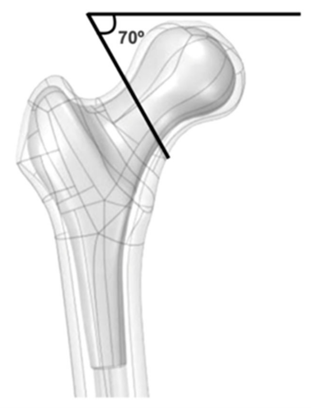 Bioengineering Free Full Text Evaluation Of A Locking
