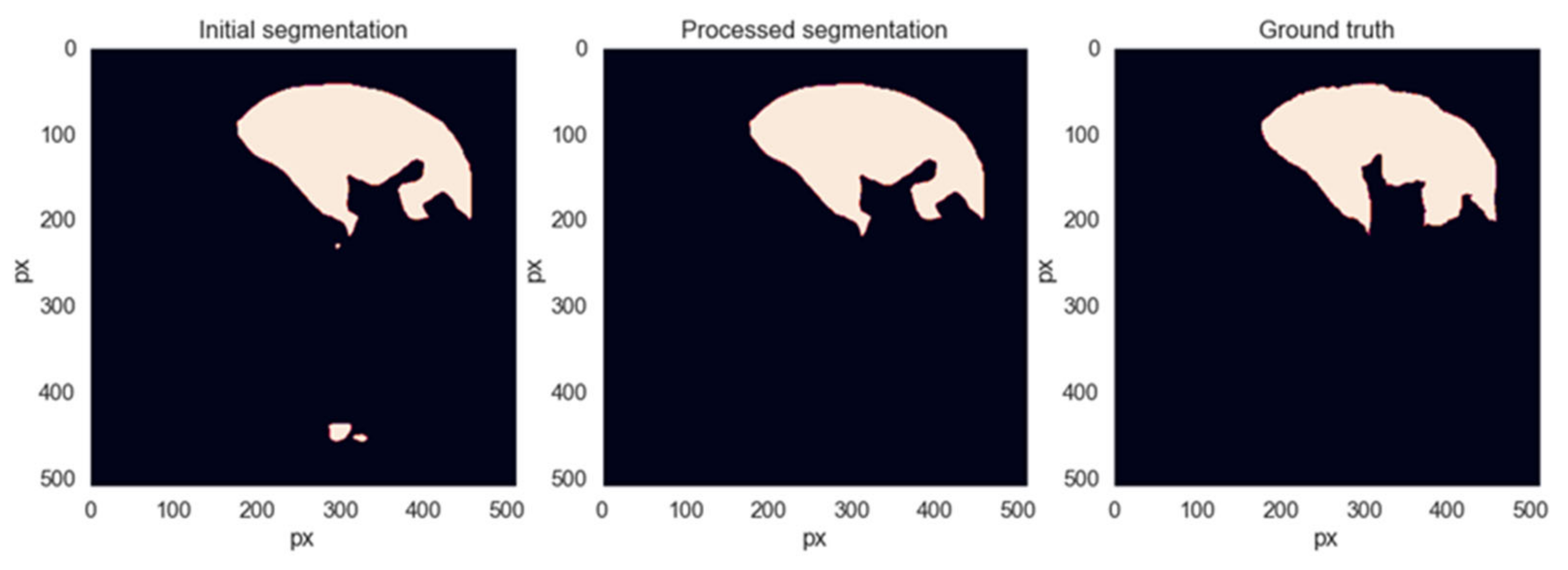 Bioengineering | Free Full-Text | Decision Support System for Liver Lesion Segmentation Based on ...