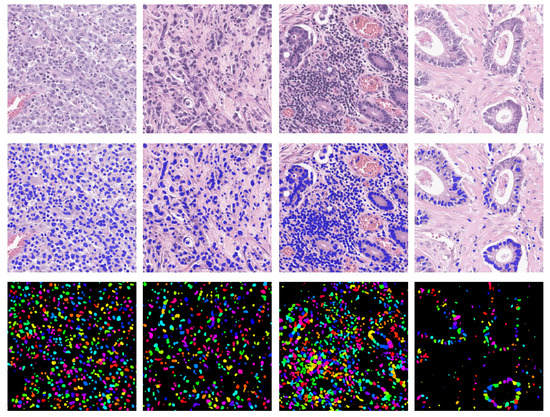 Bioengineering | Special Issue : Artificial Intelligence in Medical ...