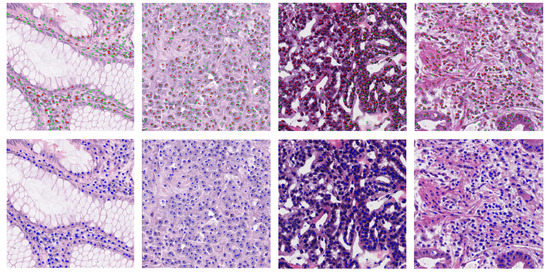 Bioengineering | Special Issue : Artificial Intelligence in Medical ...