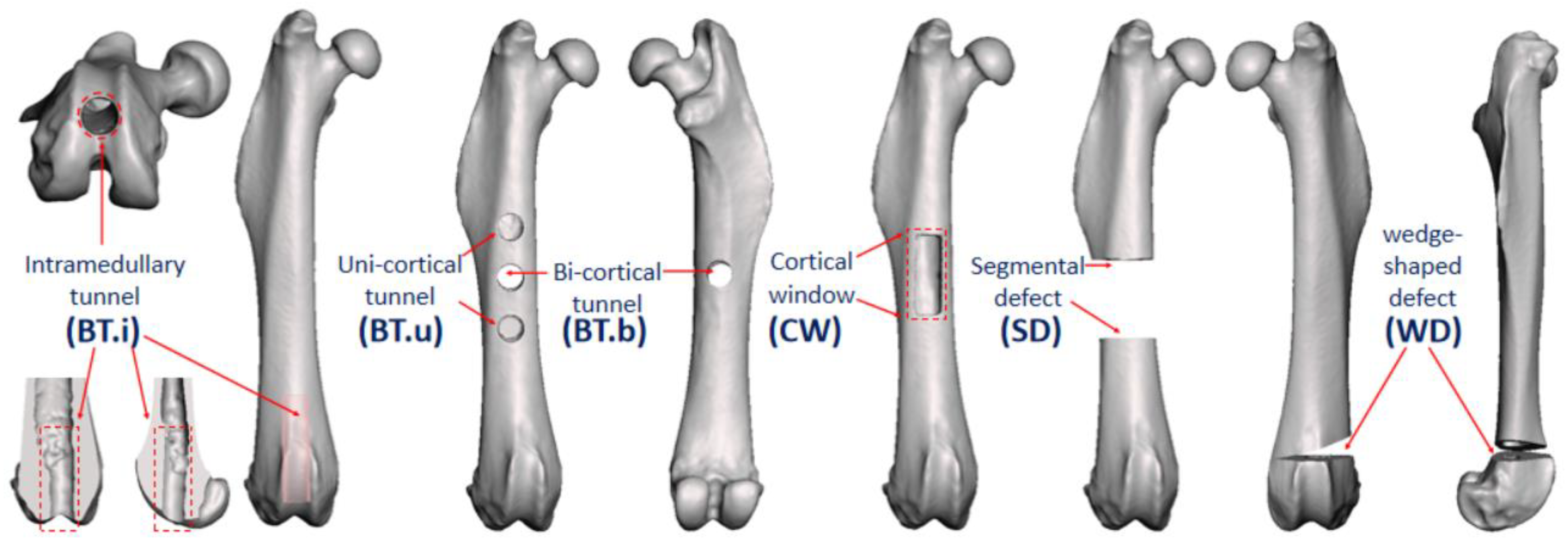 Types Of Bone Defects At Olivia Joseph Blog